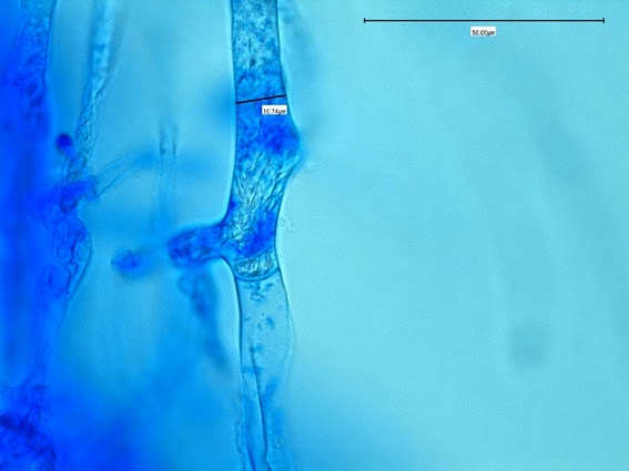 Fun With Microbiology (What's Buggin' You?): Apophysomyces elegans ...