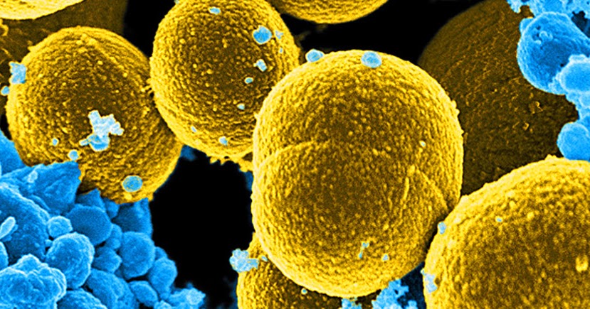 Viajando a través de la Codificación Clínica con Fioris: 12 ...