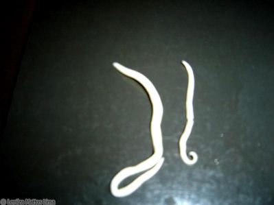 Parasitoses em Escolares