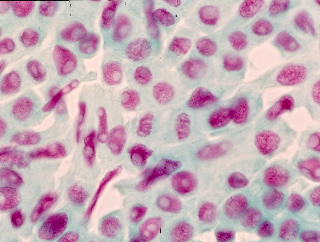 Laboratorio de Biología: MITOSIS EN MERISTEMAS VEGETAL