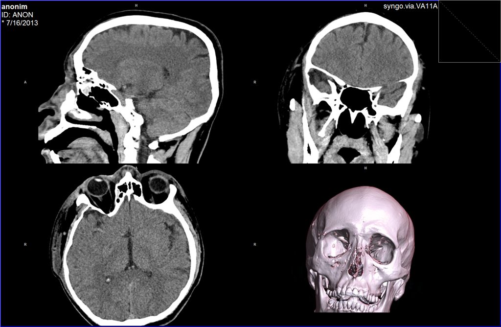 MATERI RADIOLOGI: PERBEDAAN RONTGEN,CT DAN MRI
