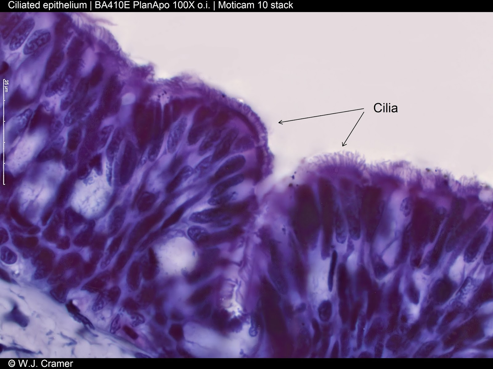 Motic Europe | Blog: Extremely tiny but very useful ‘hair’