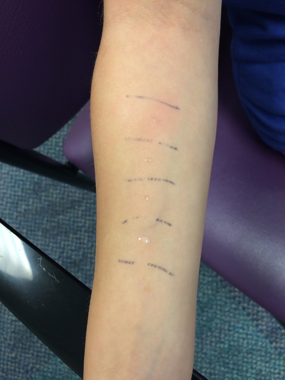 Let's Not Be Rash: Soy Test