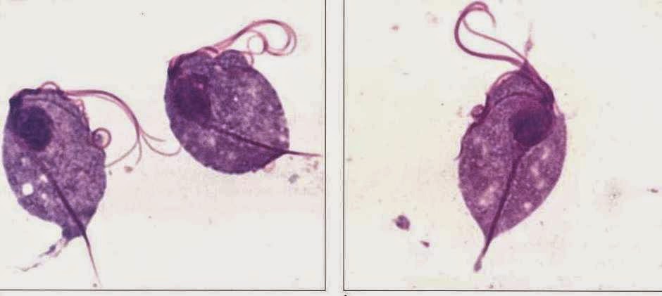 Desenmascarando a las ITS: Etiología Tricomoniasis.