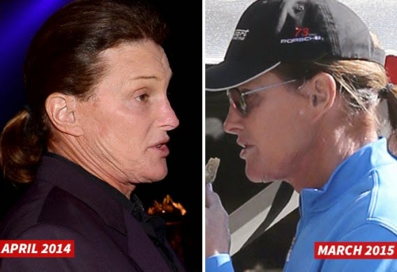 Spot any difference? They say Bruce Jenner got a nose job to look more ...