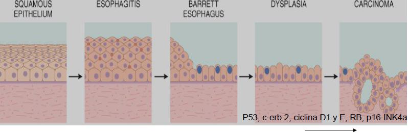 Patología : ESÓFAGO