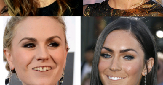 Celebrities Without Lips - Pics And Gifs