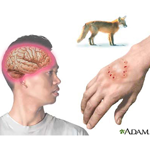 A short Intro to Rabies Pathophysiology and Treatment ~ Pharmacy Portal