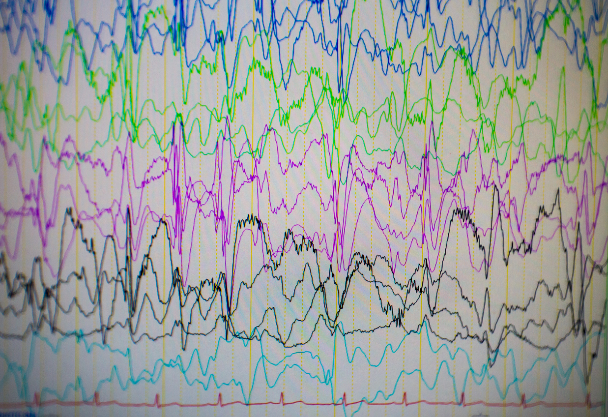 Psych News Alert: EEG Readings Not Recommended for Predicting ...