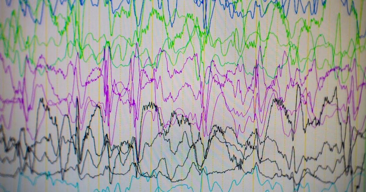 Psych News Alert: EEG Readings Not Recommended for Predicting ...