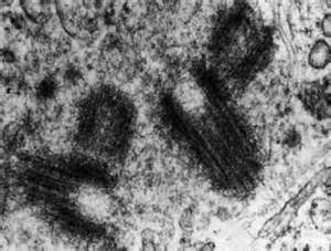 Anatomía Aplicada!!: Microscopía Electrónica