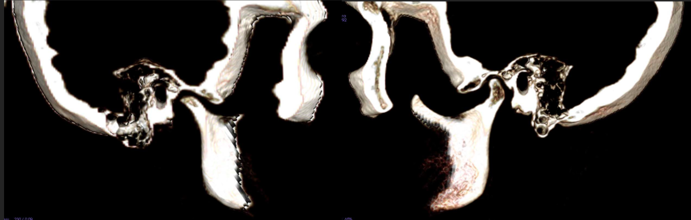 My TMJ Story: Meeting Dr. Piper!