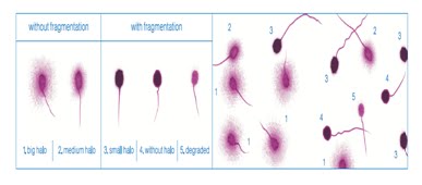 Klinik Andrologi: Uji Fragmentasi DNA