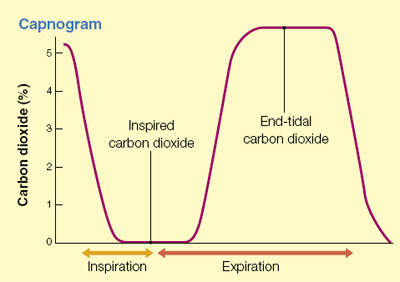 MedicoNotebook: Capnography