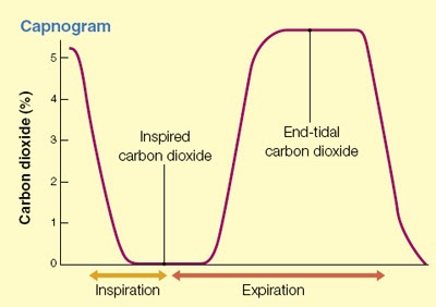 MedicoNotebook: Capnography