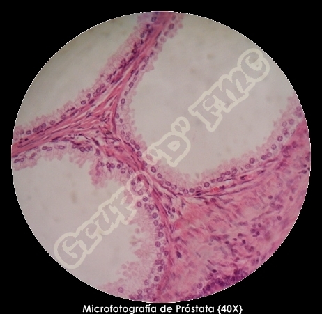 Histologeando: PRÓSTATA