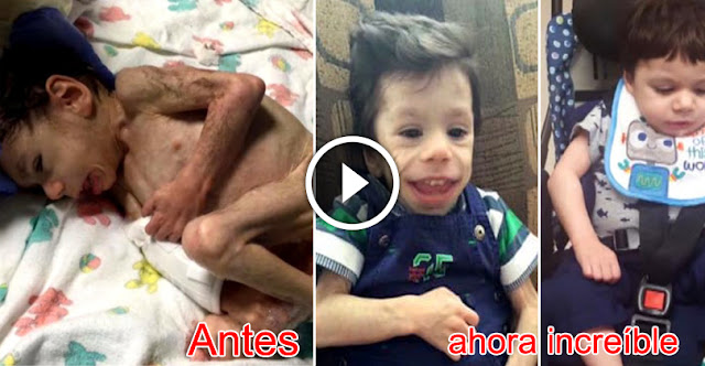 Starving 8-Year-Old Orphan Who Weighed Only 8 Lbs. Now Looks ...