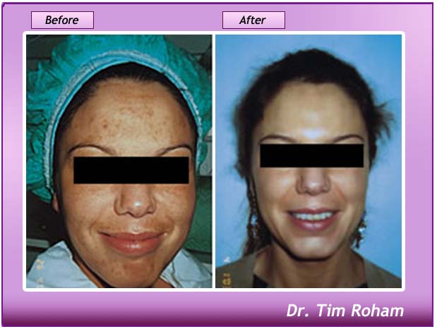 Latest Health & Beauty products today: COSMELAN