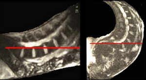 Pinoy Bone and Joint: Ouch! Do They Even Have Bones?