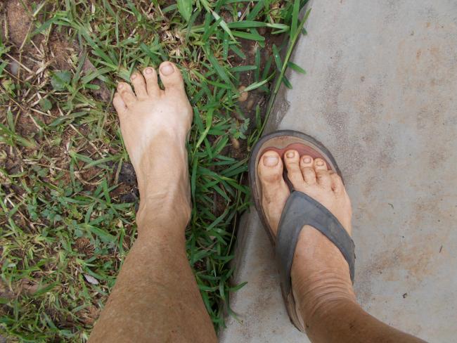 Picture my days: One shoe off and one shoe on