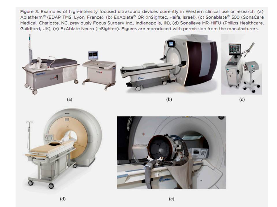 BÀI SOẠN VỀ SIÊU ÂM CHẨN ĐOÁN: HIFU in ONCOLOGY
