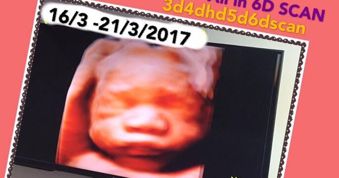 5D 6D SCAN SONOVISION: PROMOTION 5D 6D SCAN 16/3 - 21/3/2017