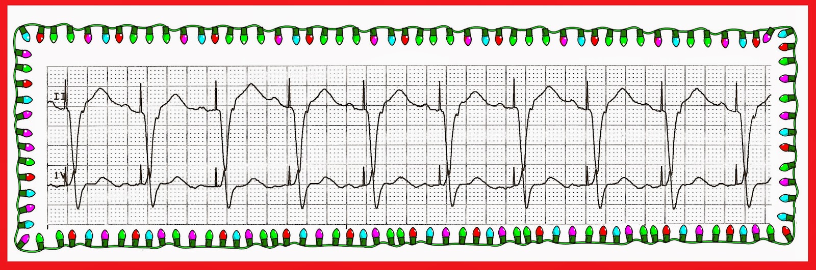 Practice EKG Strips Merry Christmas