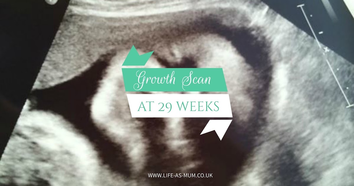 Growth Scan #1 | 29 Weeks Pregnant | Beth Owen