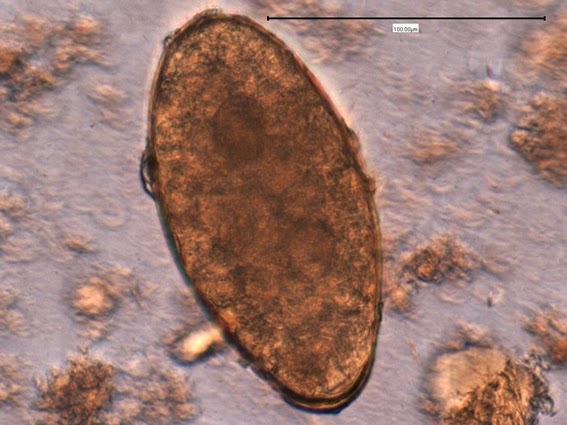 Fun With Microbiology (What's Buggin' You?): Fasciola hepatica