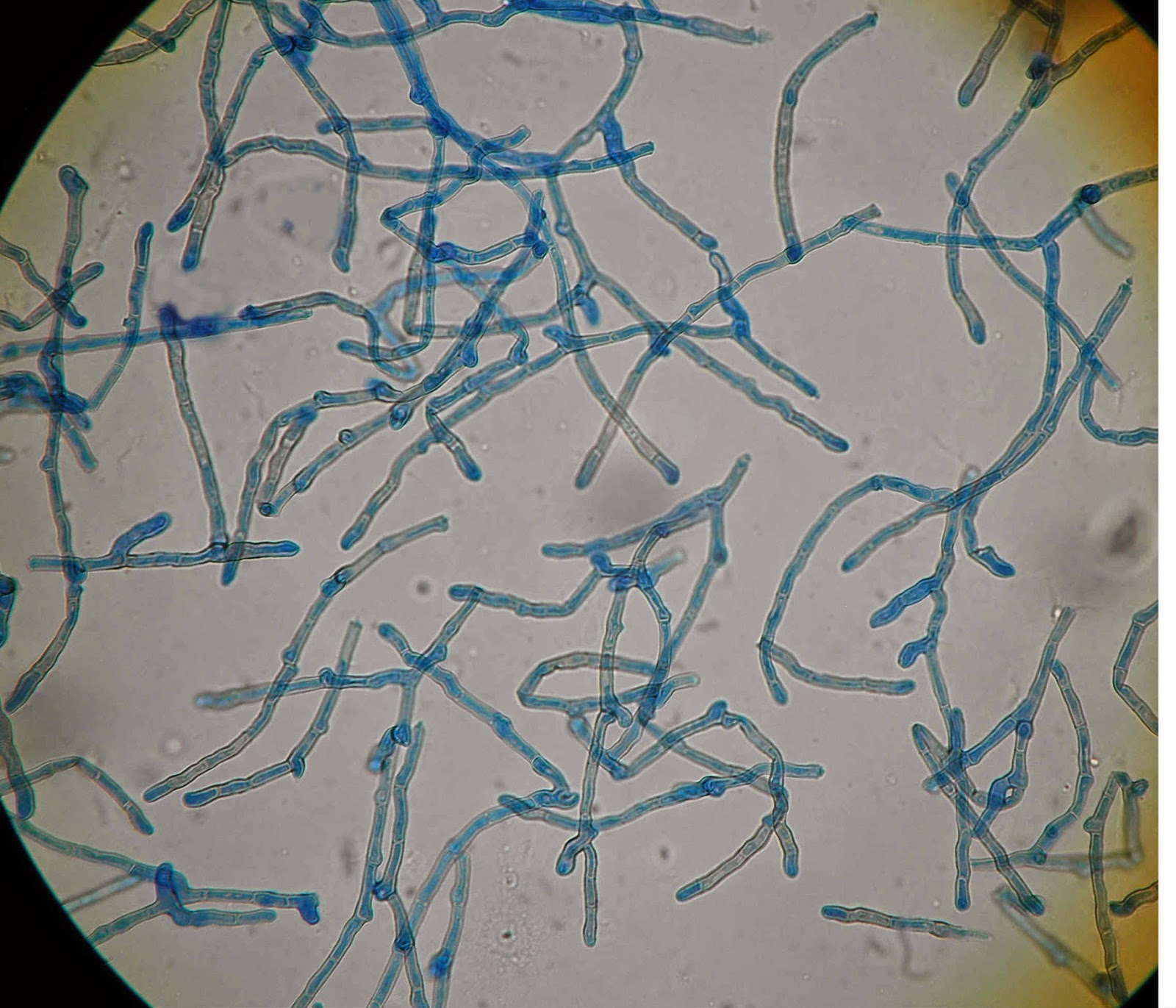 ATLAS MICOLOGIA: EXSEROHILUM ROSTRATUM
