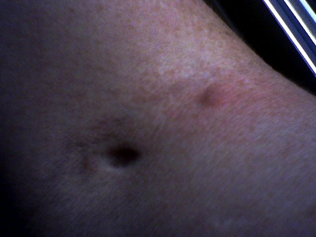 Meth and Me; Diary of a Tweaker: My Meth Photo Archive