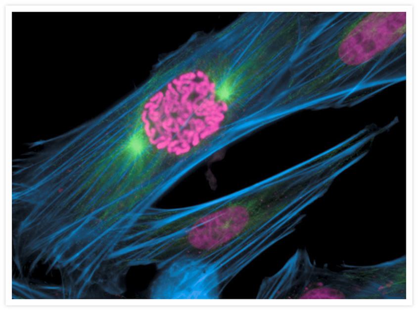 Méduses: GFP