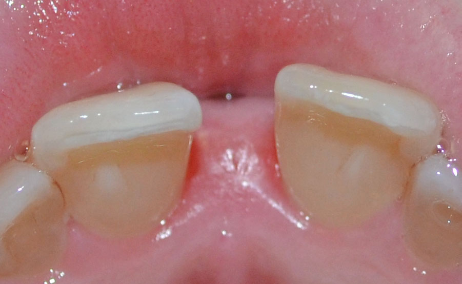 Amy's SARPE Adventure: January 2013