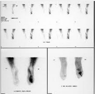 Nuclear Medicine Exams Explained - For The Patient: Nuclear Medicine ...