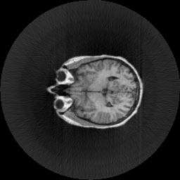 crazybiocomputing: Learning Tomography: Where are the sinograms?
