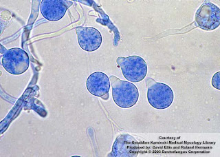 Basidiobolus: Basidiobolus