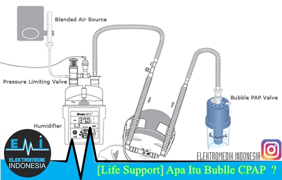 Apa itu Bublle CPAP ? [LIFE SUPPORT]