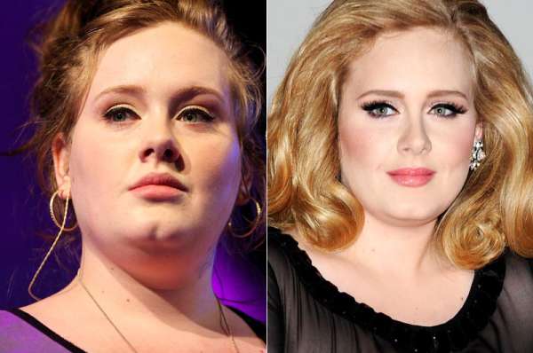 Adele Plastic Surgery