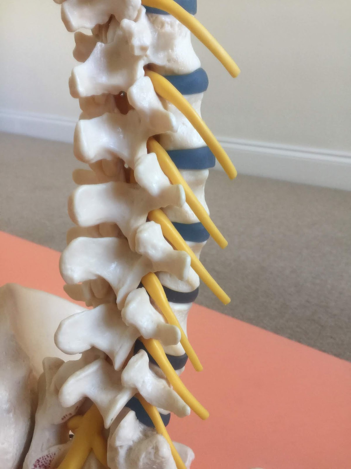 Loss of high of disc??