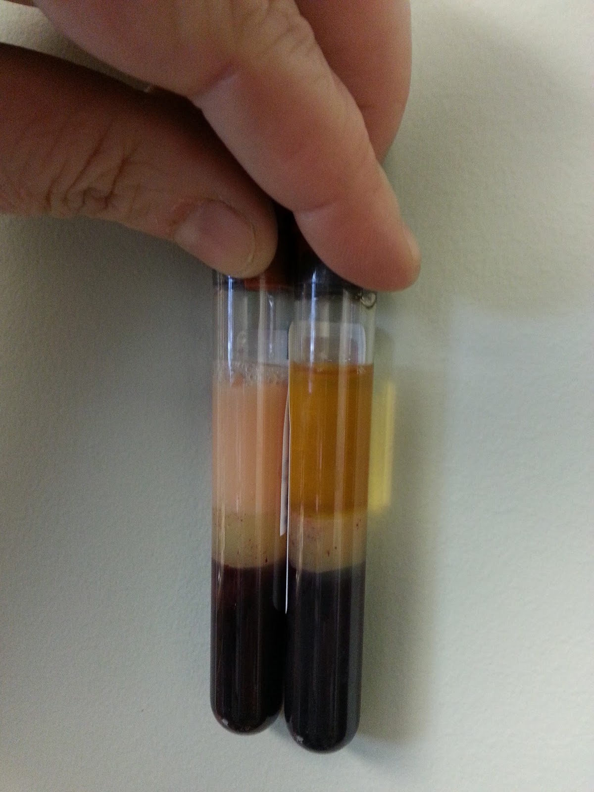 Health Talk: March 2013