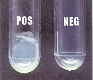 Um Convite à Biomedicina: Identificação de bactérias - Catalase e Coagulase