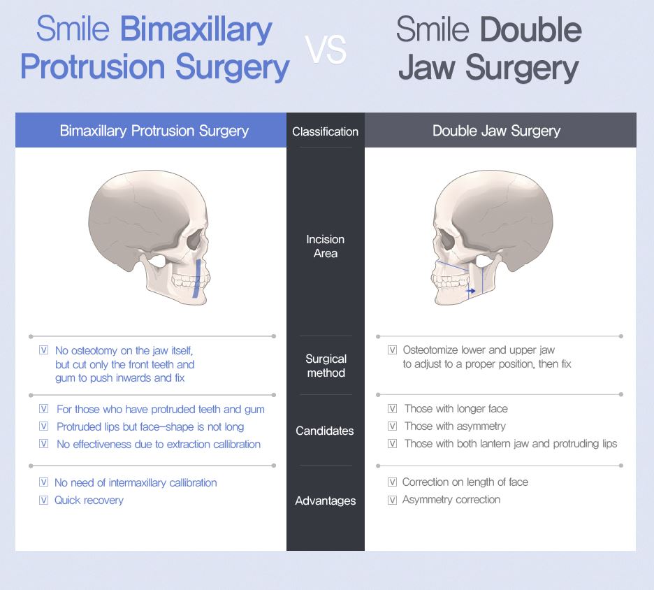 Smile Bimaxillary Protrusion Surgery VS Smile Double Jaw Surgery
