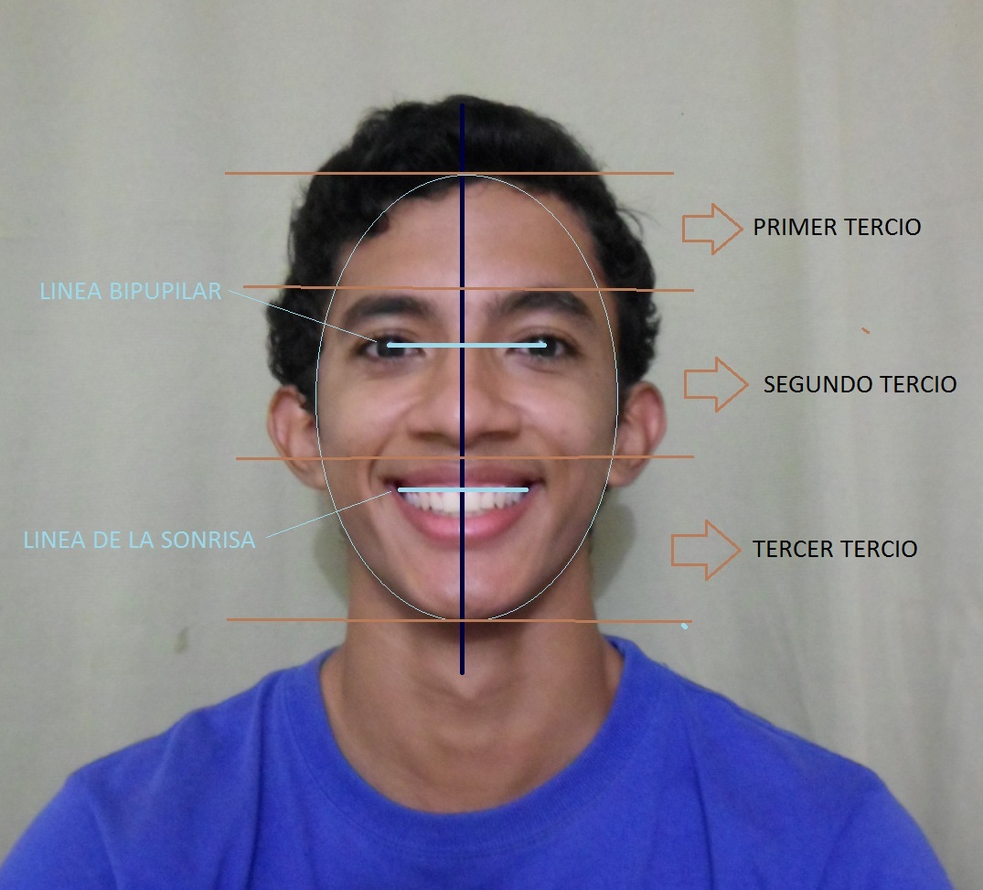 Dentistry's place.: ANÁLISIS DE SONRISA