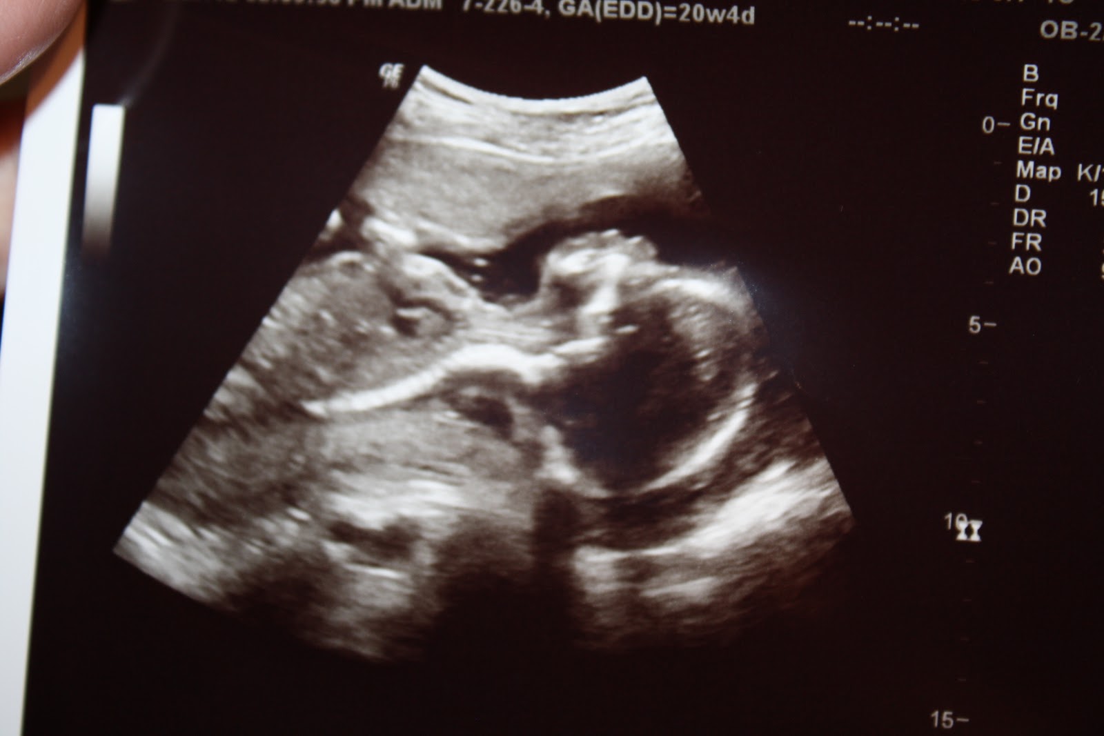 Baby Babbles: 20 Weeks: Half Way!