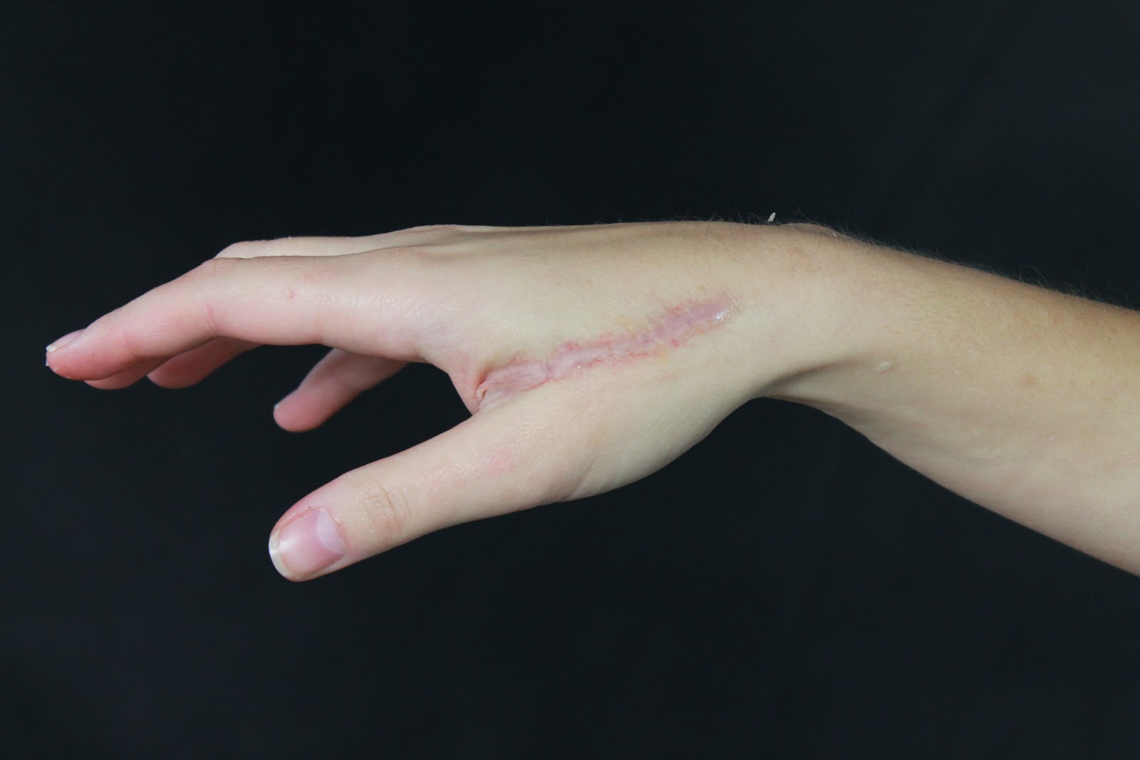 Valertine Myland: Rany, rany, rany...