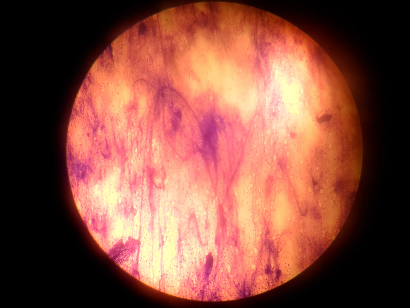 Ourlad's Paradigm: Nervous Tissue