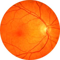 Study finds benefit of comprehensive eye exam and retinal photography ...