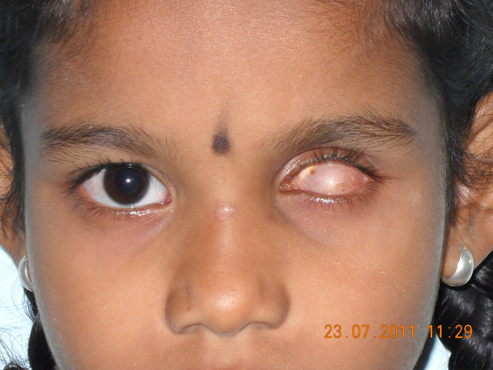 Sight to the Sightless