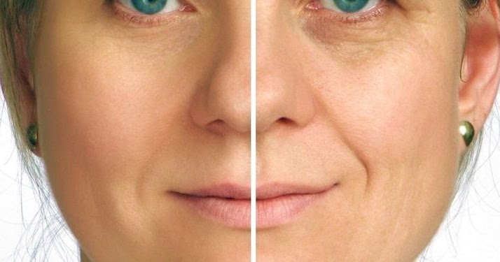 Remove Age Spots On Face Quickly Top Secret Skin Tips remove-age-spots-on-face-quickly-top-secret-skin-tips