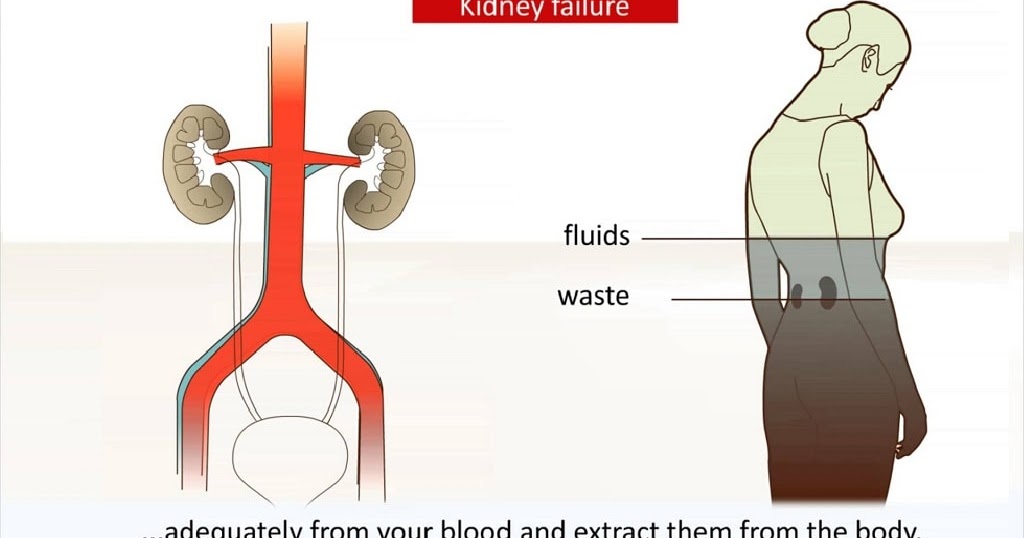 Health Knowledge : What are the symptoms of early renal insufficiency?